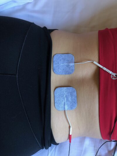 CellStim Microcurrent Therapy rapidly relieves back pain