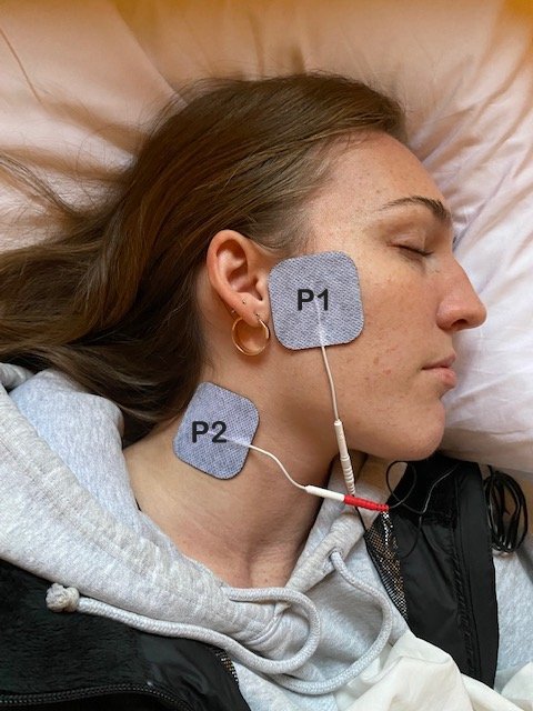 Vagus Nerve and Long-Covid - CellStim